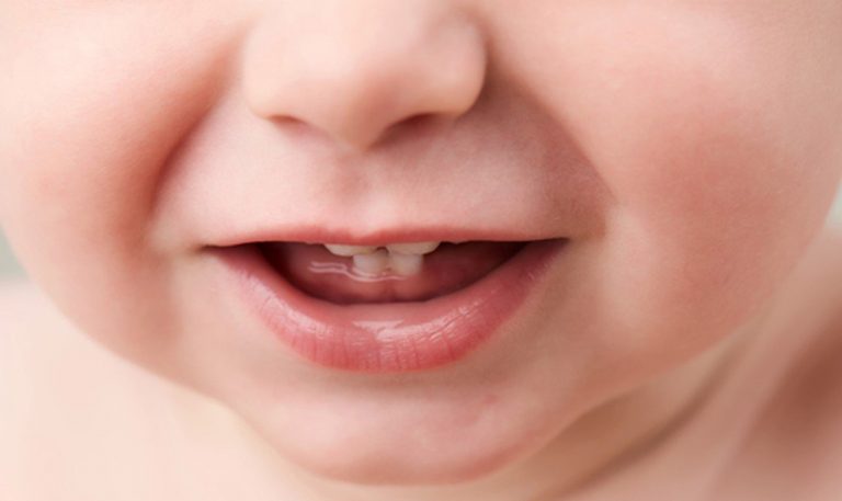¿Sabías que algunos bebés nacen con dientes? – Sonrisas y Más MX